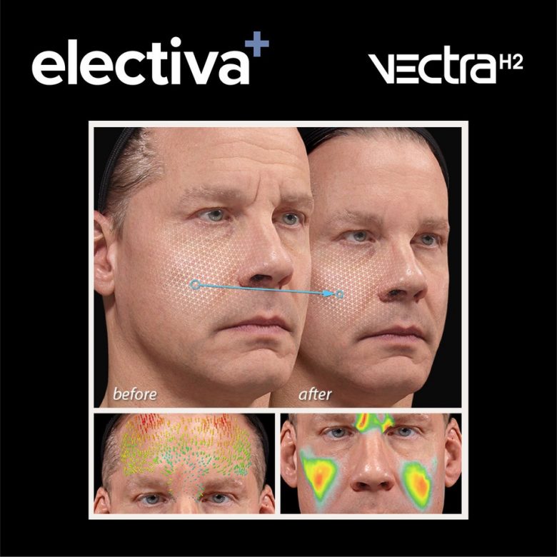 Driving Evidence-Based Aesthetic Practice with 3D Imaging – Electiva